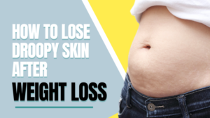 How to lose Droopy Skin after Weight Loss - Brand Surgical Institute